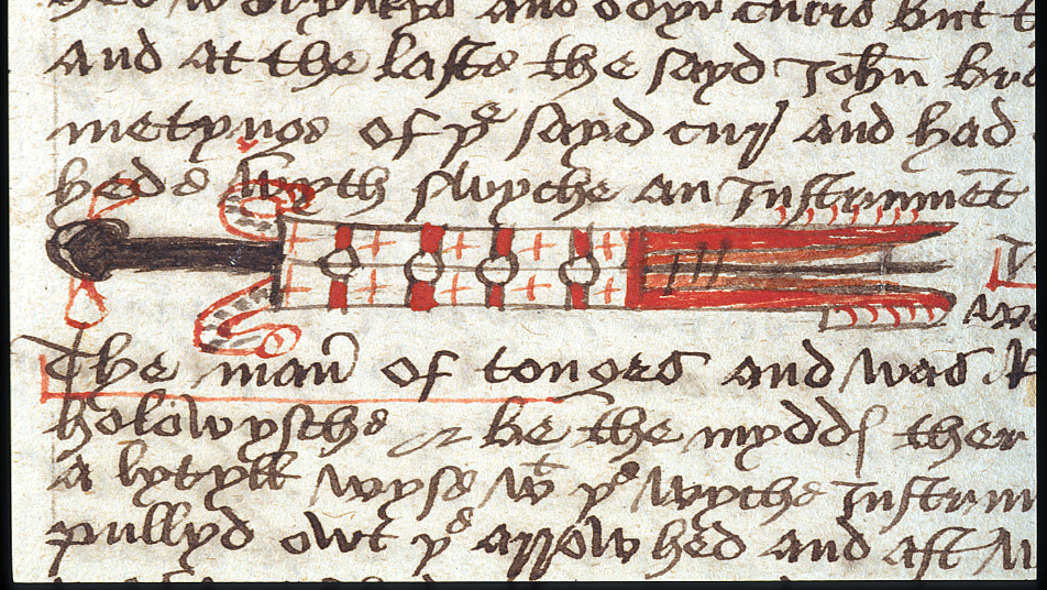 Henry V’s Absent Scar – A Place Between The Trees